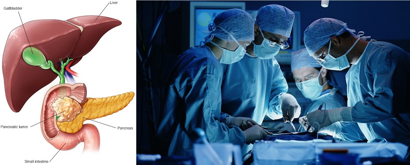 ΧΕΙΡΟΥΡΓΙΚΗ ΟΓΚΟΛΟΓΙΑ - Κωνσταντίνος Τσιγκρίτης